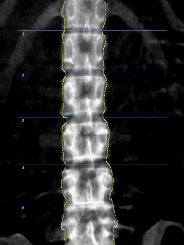 InAlyzer AIR – medikors